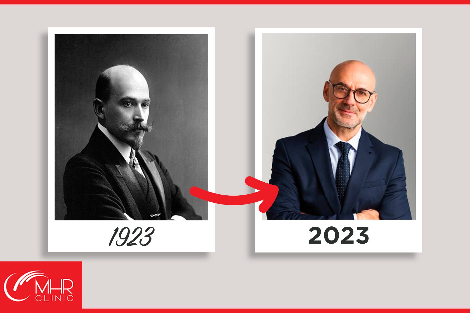 How Hair Loss Statistics Have Evolved Over the Last 100 Years | MHR ...