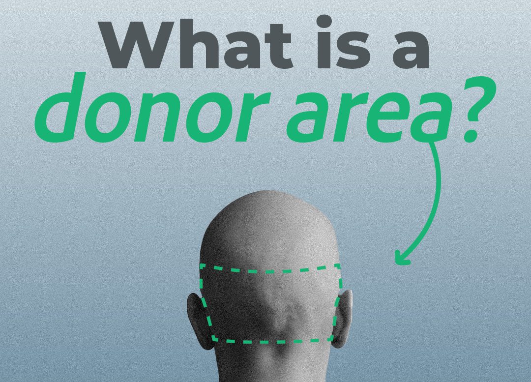What Is a Donor Area in a Hair Transplant? | MHR Clinic UK | Hair ...